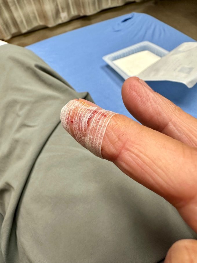 Moving Boxes and Slicing Open a Finger - Gary Borders